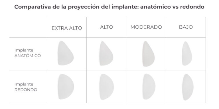 ¿Prótesis redondas o anatómicas? Cuáles son mejores para un aumento ...